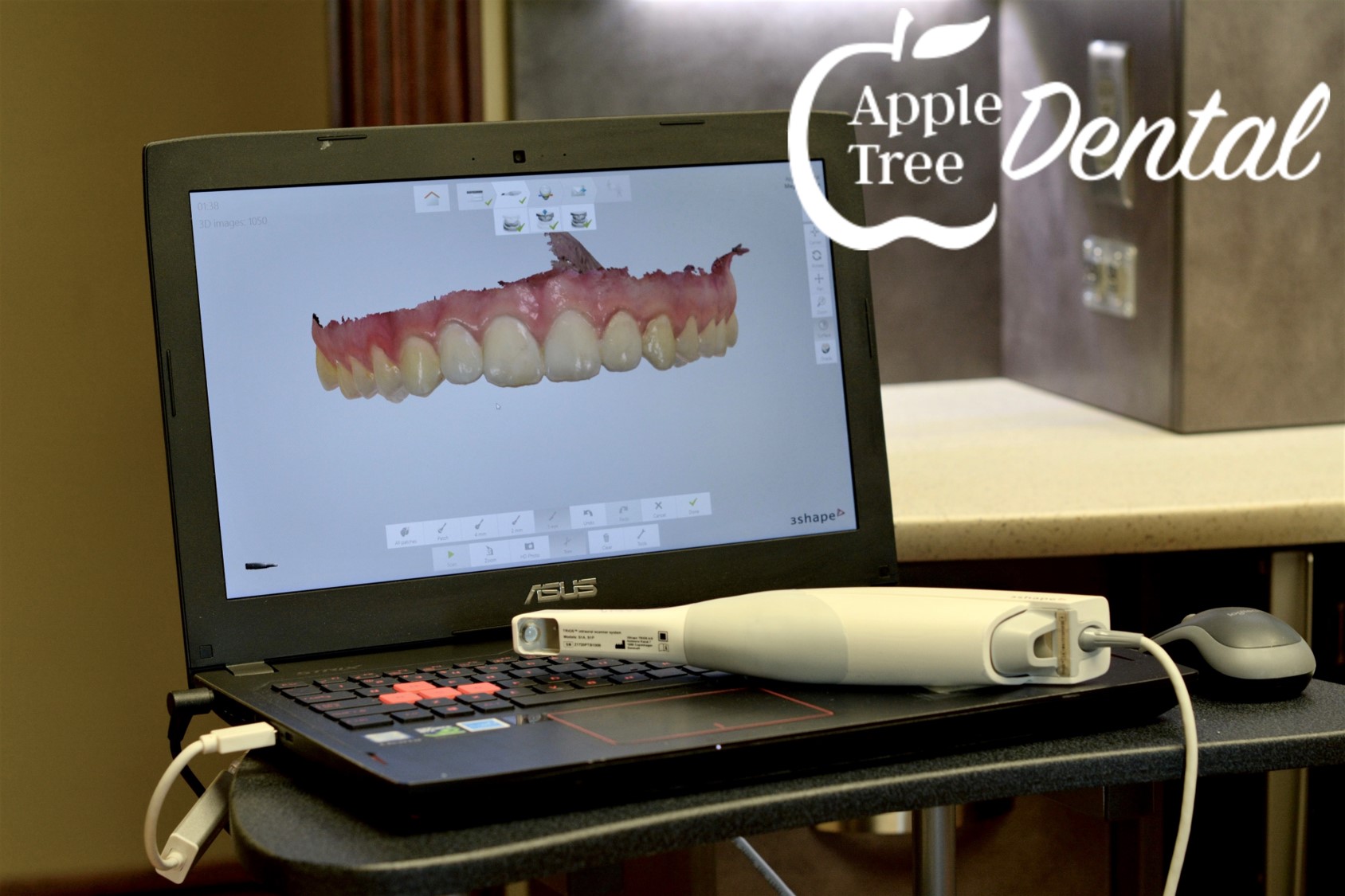 No Messy Dental Impressions Blog